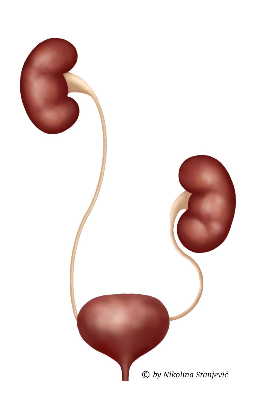 Laparoscopic nephropexy